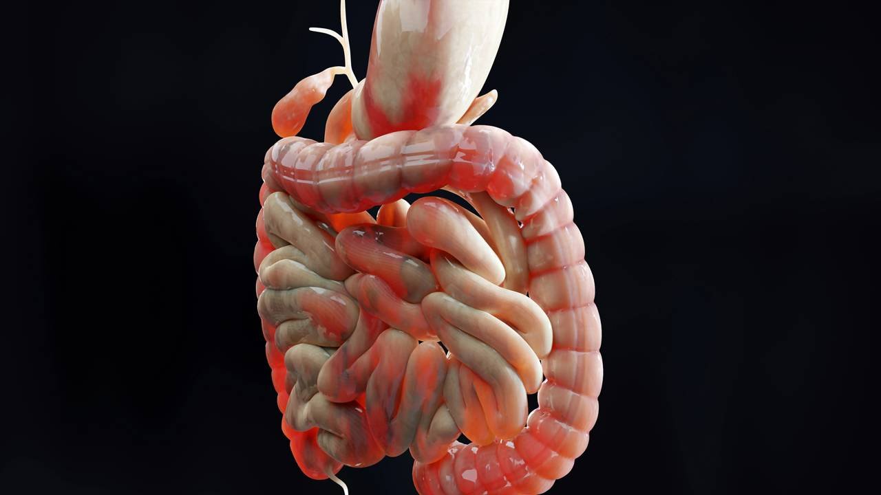 Conhece a doença de Crohn? Saiba tudo sobre ela - Correio Braziliense ...
